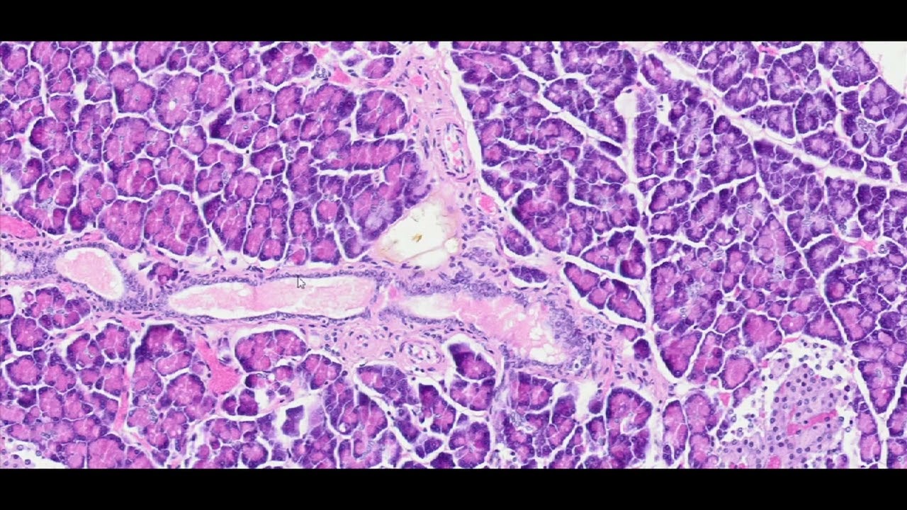 Pancreas Gland Slide Labeled