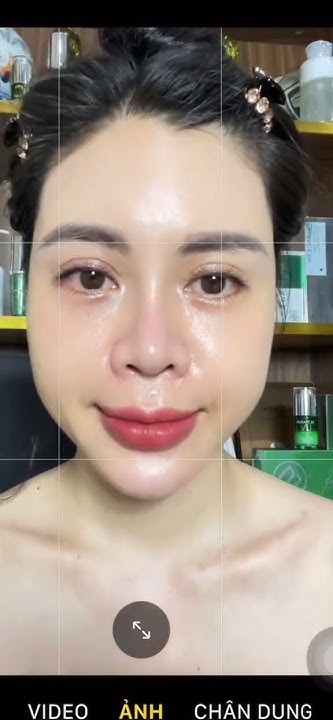 Đỡ Nám Mụn thì duy trì dưỡng em này nhé L - Bacilus #huonglurcinn #lurcinnsglobal #cang - YouTube