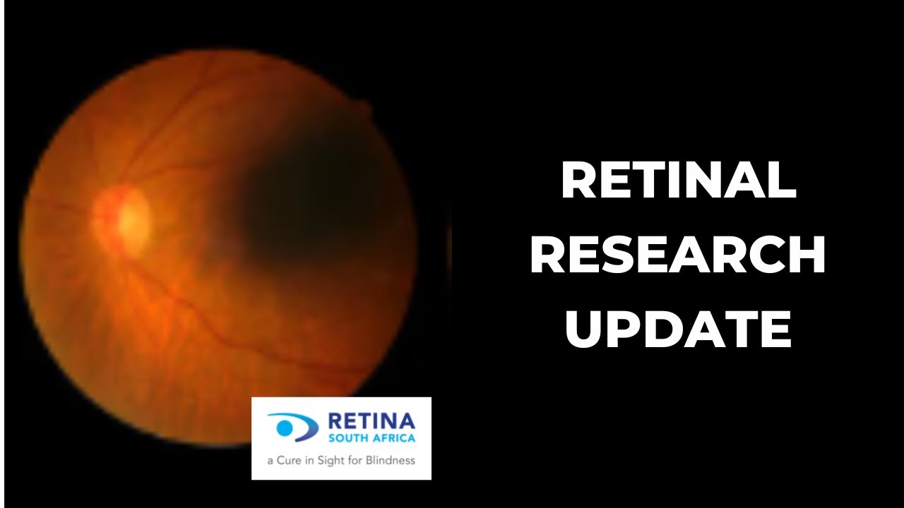 Retinal Research Update - YouTube