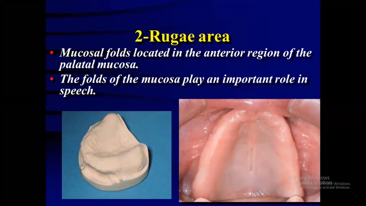 Prosthodontics L1 part1 (Anatomical landmarks of edentulous arches ...