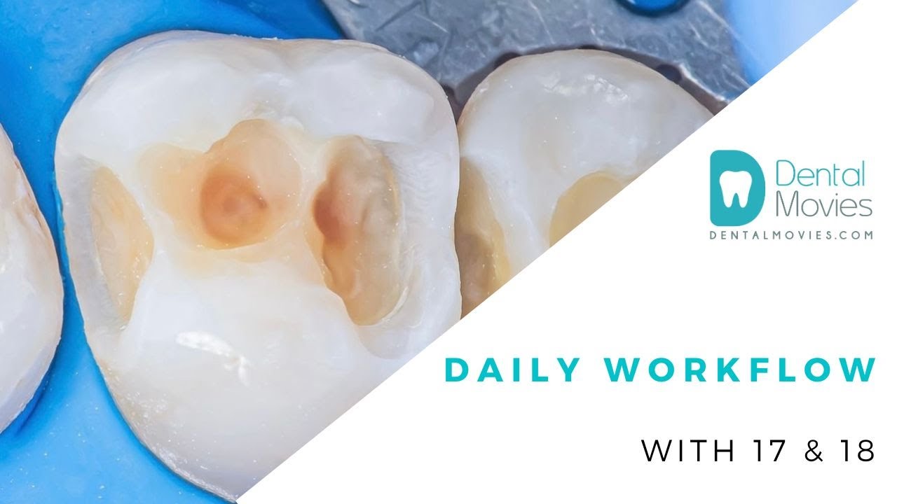 Daily workflow with 17 & 18 - YouTube