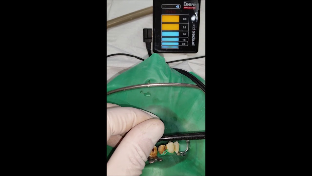 PROPEX pixi - YouTube