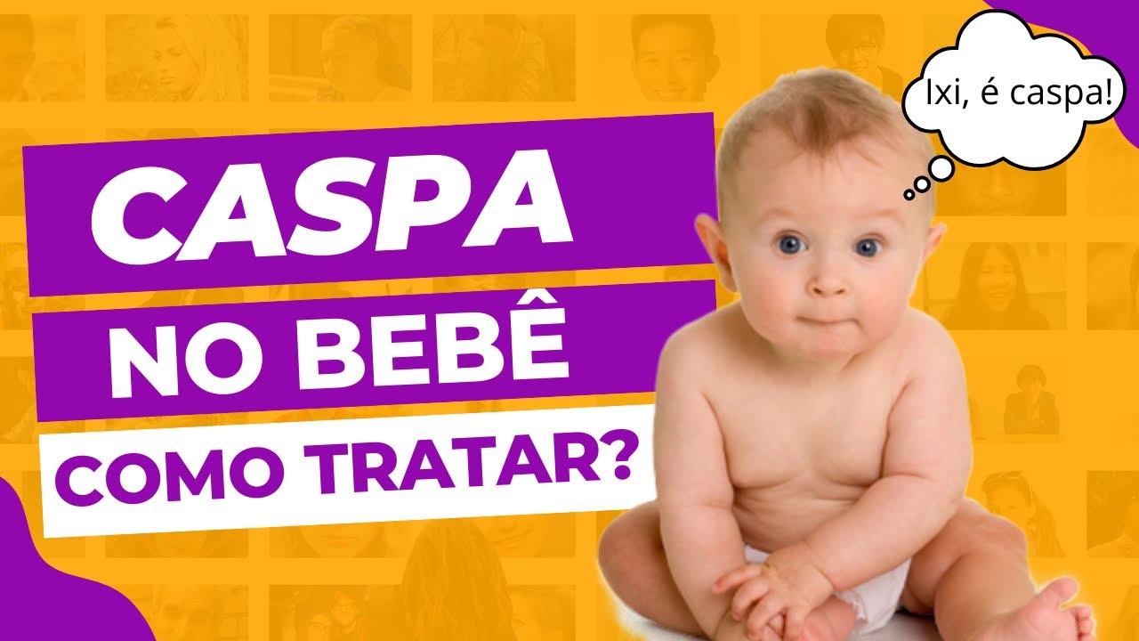 Caspa no bebê? Saiba como tratar a crosta láctea - YouTube