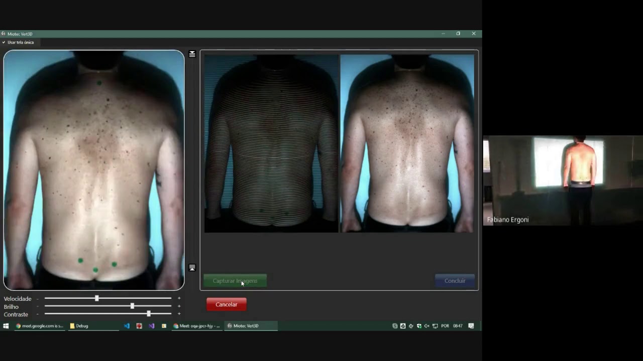 Miotec - Demonstração Clínica do Scanner Postural Vert 3D - YouTube