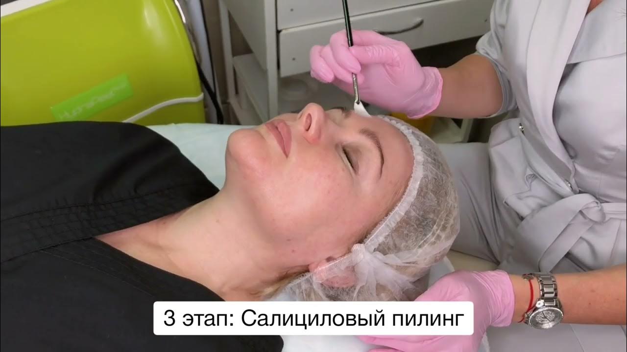 Салициловый пилинг - YouTube