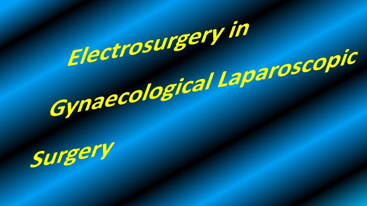 Safe Use of Electrosurgery in Gynaecological Laparoscopic Surgery, TOG ...