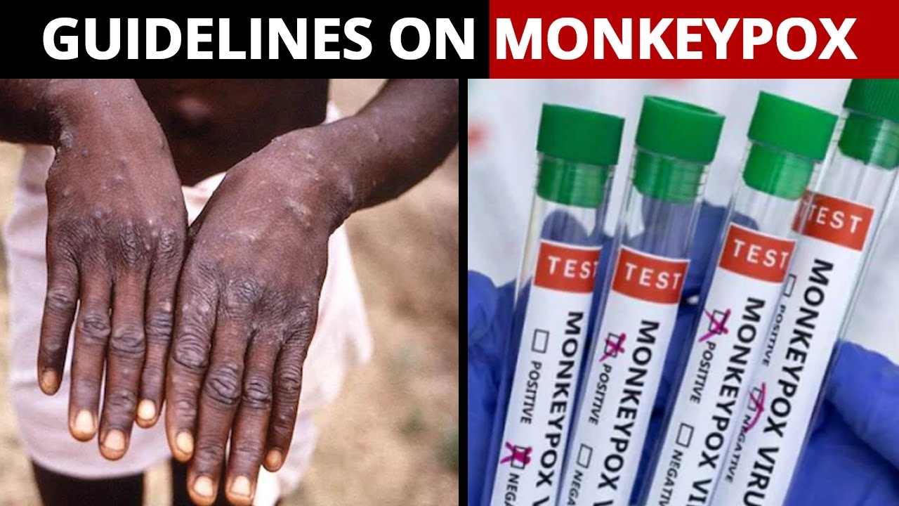 Monkeypox Virus: Isolate Those Infected, Govt Issues Guidelines To ...