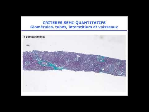 Anapath en transplantation rénale - YouTube