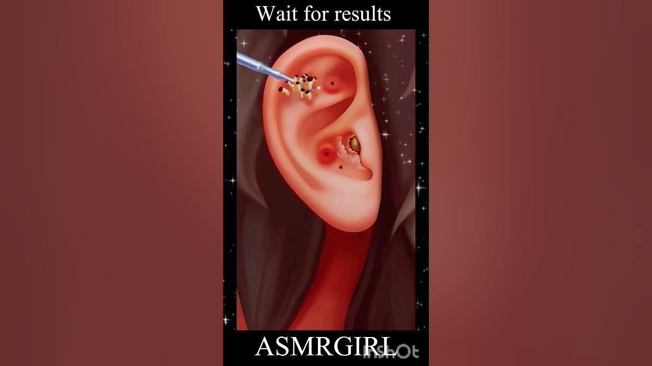 Ultra Relaxing Ear Cleaning ASMR | Deep Ear Attention for Sleep & Tingling Sensations #asmr ...