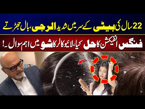 22 Years Old Girl Facing Huge Dry Hair & Dandruff Issues | Must Listen Reply of Dr Haroob Nabi