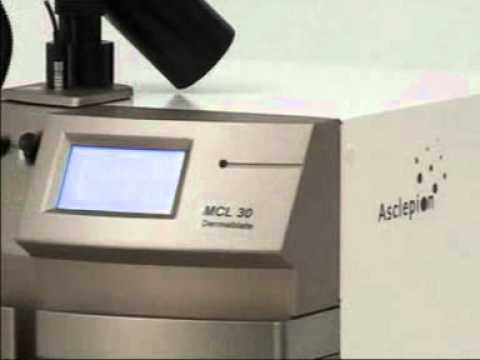 Asclepion MCL 30 Dermablate - YouTube