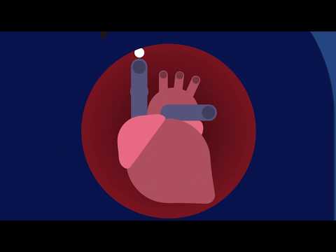 What is a Domino Liver Transplant?