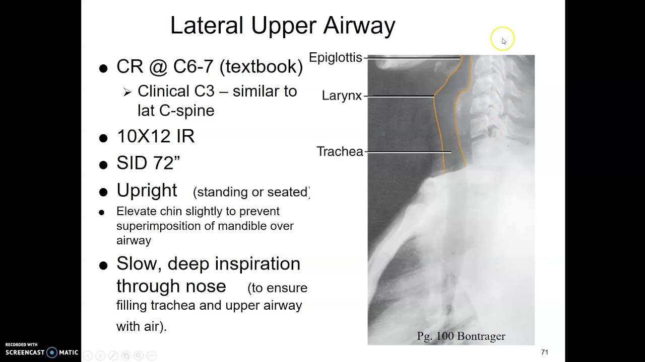 Soft Tissue Neck YouTube soft-tissue-neck-youtube