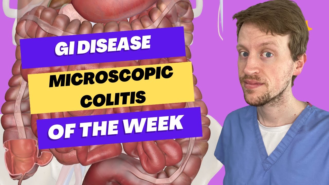 Microscopic Colitis in under 90 Seconds - YouTube