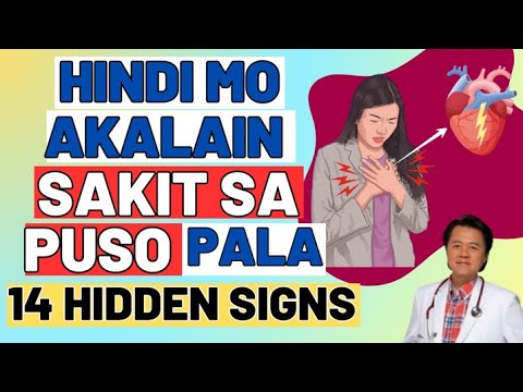 Hindi Mo Akalain Sakit sa Puso Pala. 14 Hidden Signs. - By Doc Willie ...