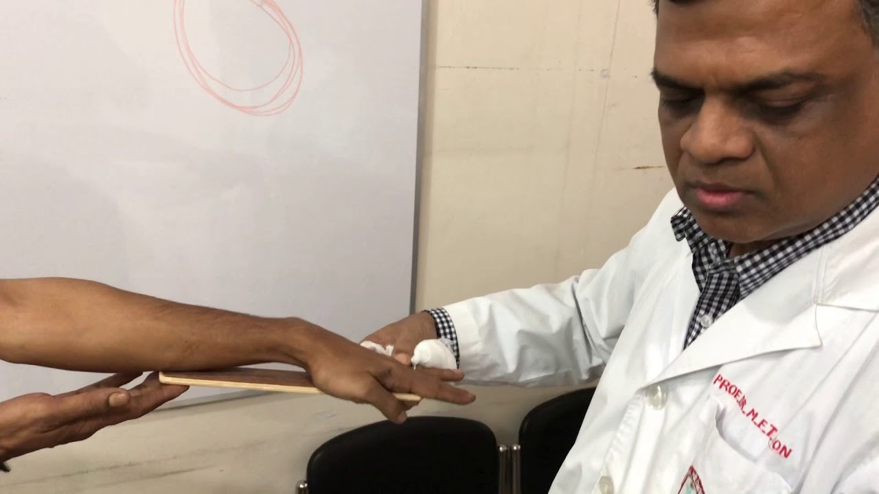 Application of "Wooden Splint" - YouTube