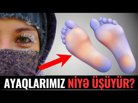 Ayaqlarınız Üşüyürsə Vacib İzləyin - Qadınlar niyə çox üşüyürlər?