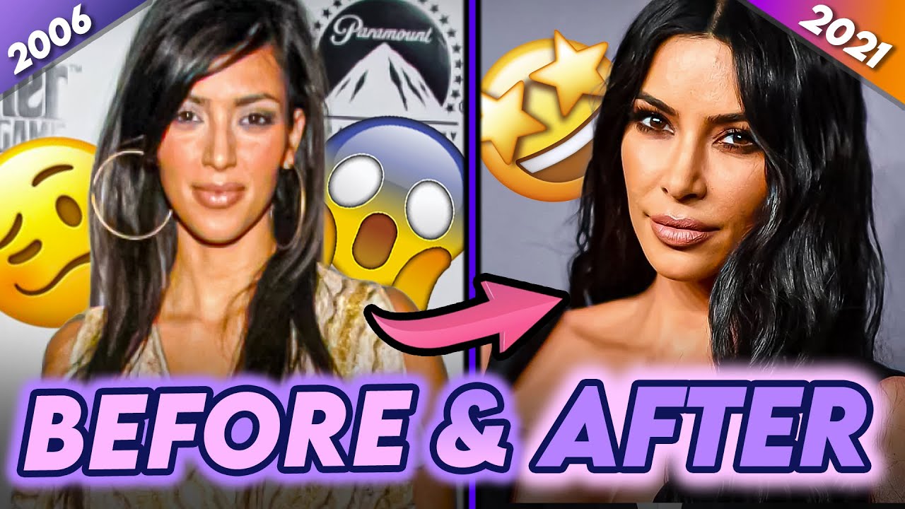 Kim Kardashian | Before & After | History Of Her Plastic Surgeries ...