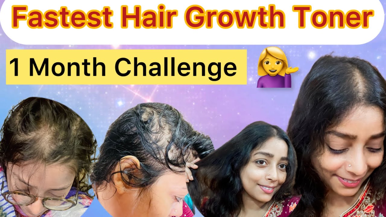 Fastest Hair Growth Toner💯1 Month Challenge👍#viralvideo#youtube# ...