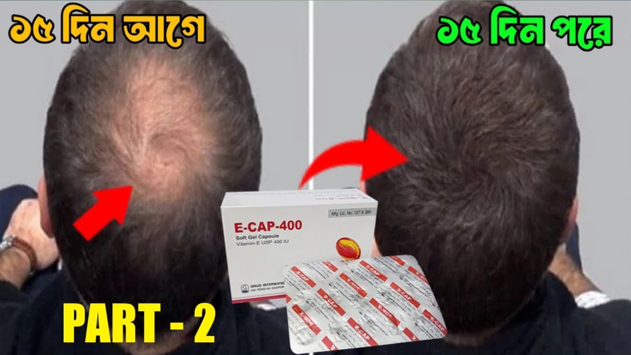 e-cap-400-part-2-how-to-use-vitamin