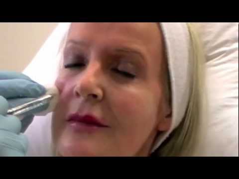Volbella and Voluma Demonstration - YouTube