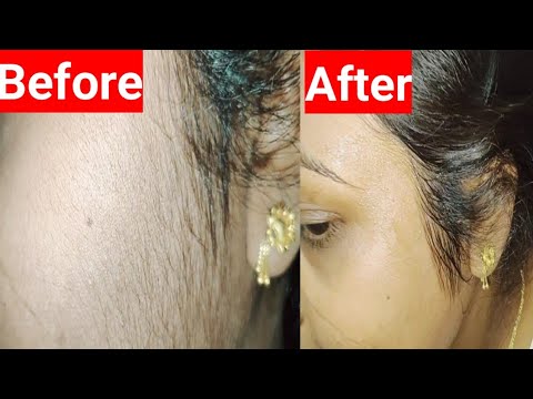 Face hair removal step by step।Face waxing।Face wax @juthikasmakeover ...