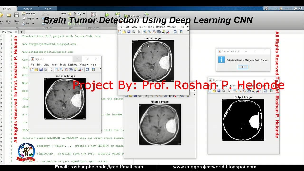 Brain Tumor Detection Using Deep Learning CNN | Brain Tumor Segmentation Using Matlab Project ...
