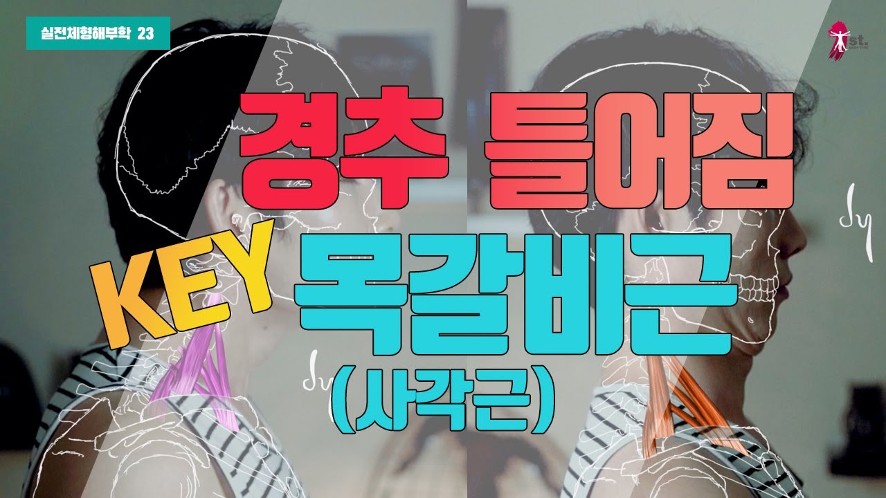 It may be because of these scary muscles! The Scalene muscles (GDY ...