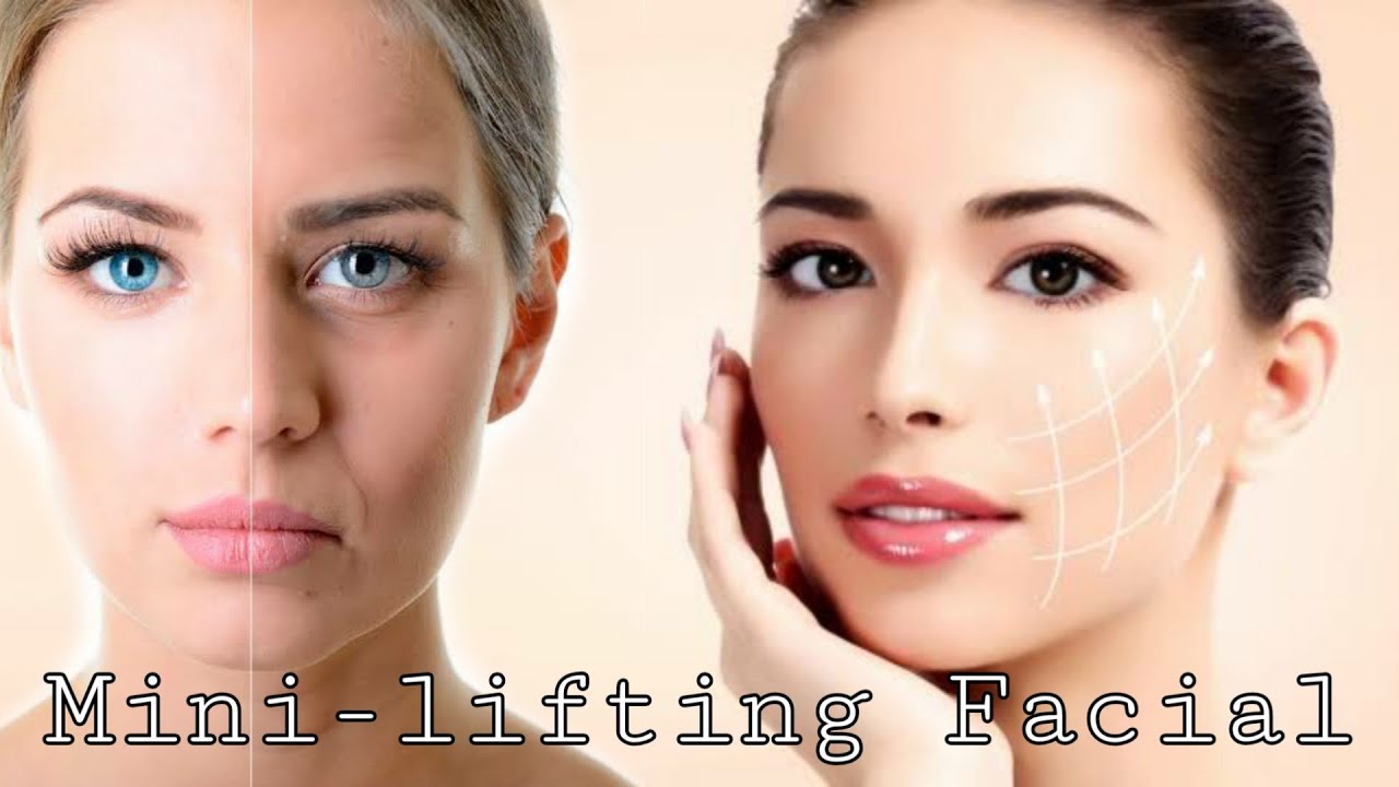 Minilifting Facial - Estética - YouTube