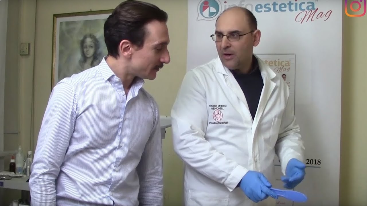 Depilazione definitiva a Roma - dr. Andrea Menichelli - laser a diodo ...