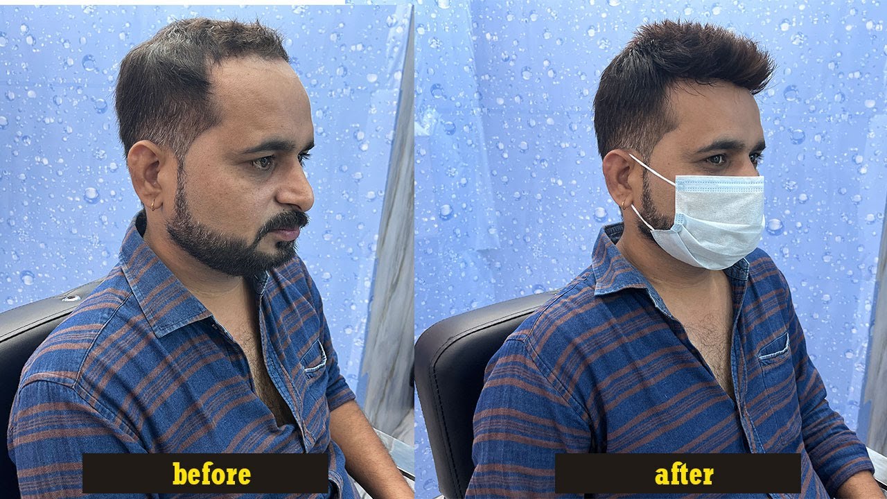 Hair clipping system for men in Gurugram | Hair patch clip system ...