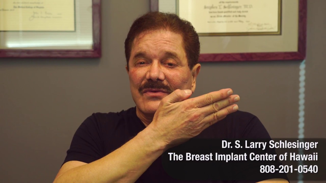 Breast Implants Under The Muscle vs Over - What Dr. Schlesinger ...