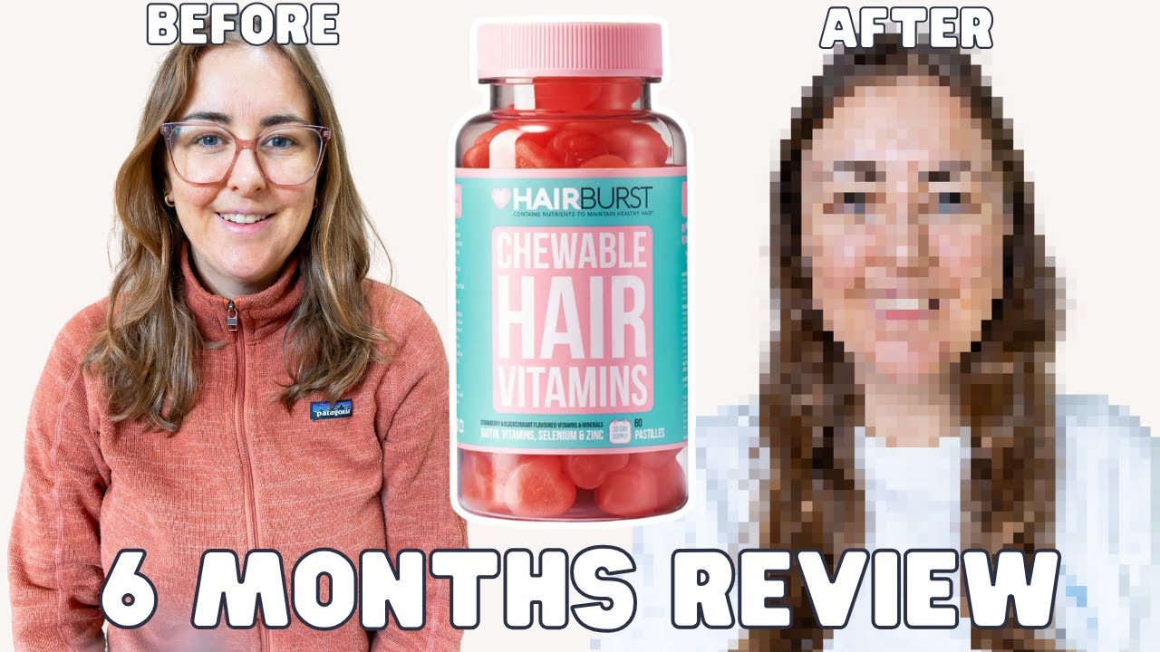Hairburst (Unsponsored) Review After 6 Months | Do These Hair Growth ...