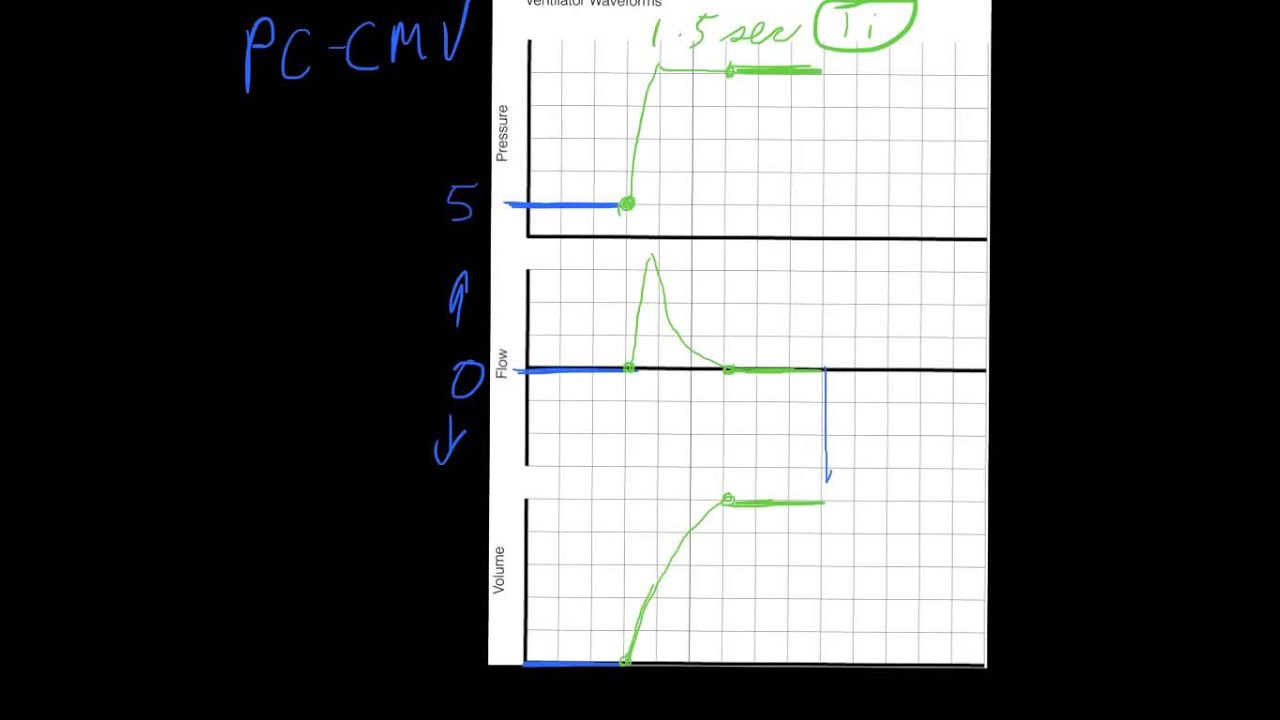 Ventilator Mode & Waveforms Review - YouTube