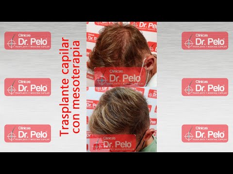Tratamiento capilar con mesoterapia + Láser capilar LedHair + Tratamiento médico. Clínicas Dr. Pelo