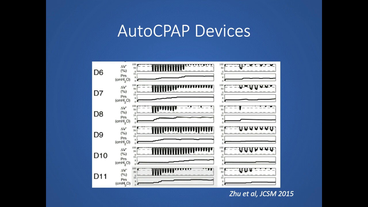 How to Improve Adherence in Patients Titrated at Home by Auto CPAP ...