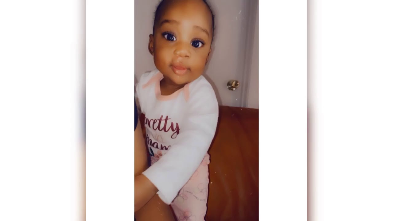 Cleft lip princess Cute babies - YouTube