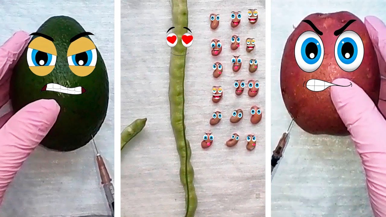 The birth of a babies in a beans, potato and avocado | C-Section ...