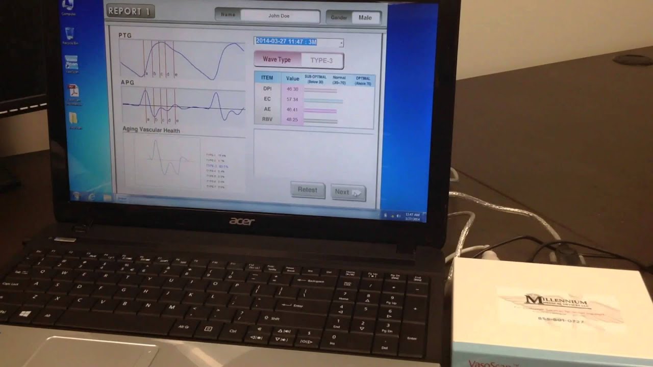 Vaso Scan video provided by PharmaTopical.com - YouTube