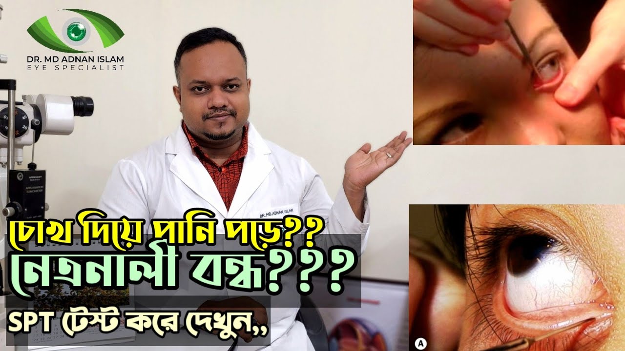 চোখ দিয়ে পানি পড়ে??? Sac patency test.করান।দেখুন কিভাবে করে?? Eye ...