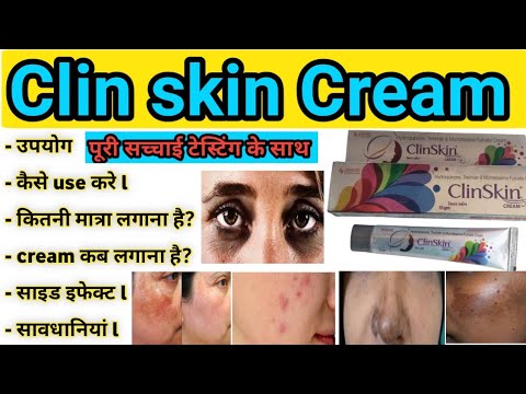 clinskin cream full review in Hindi | Clinskin cream | skin lightening ...