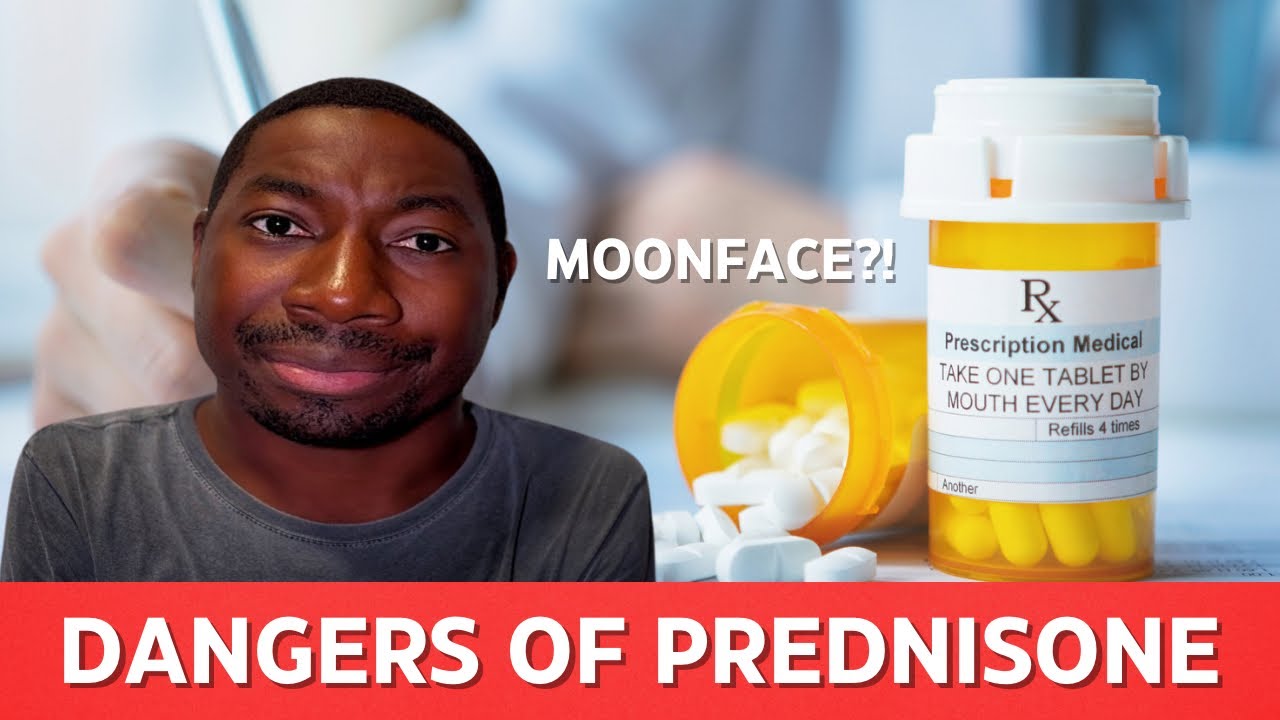 Prednisone side effects to be aware of | moonface, acne, weight gain ...