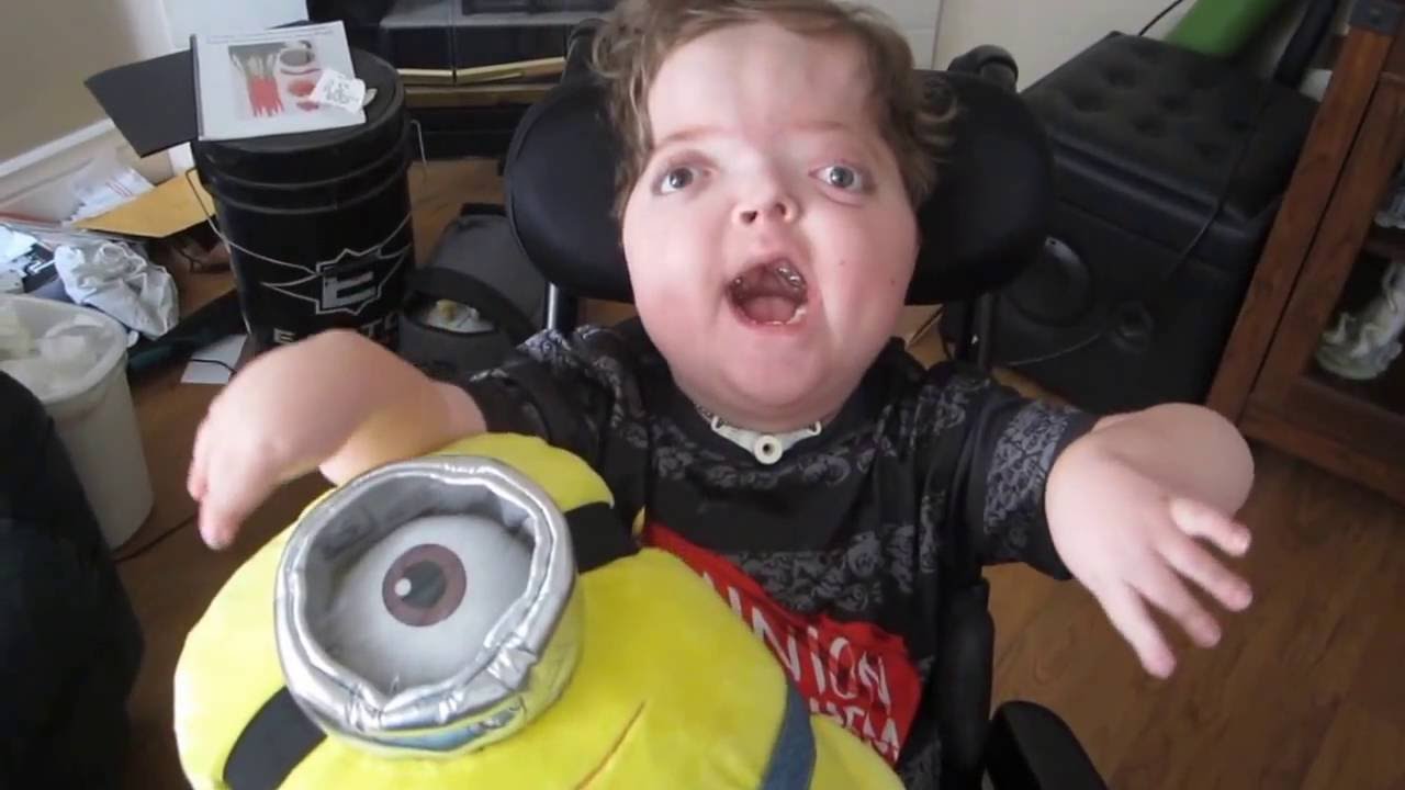 Minion surgery - YouTube