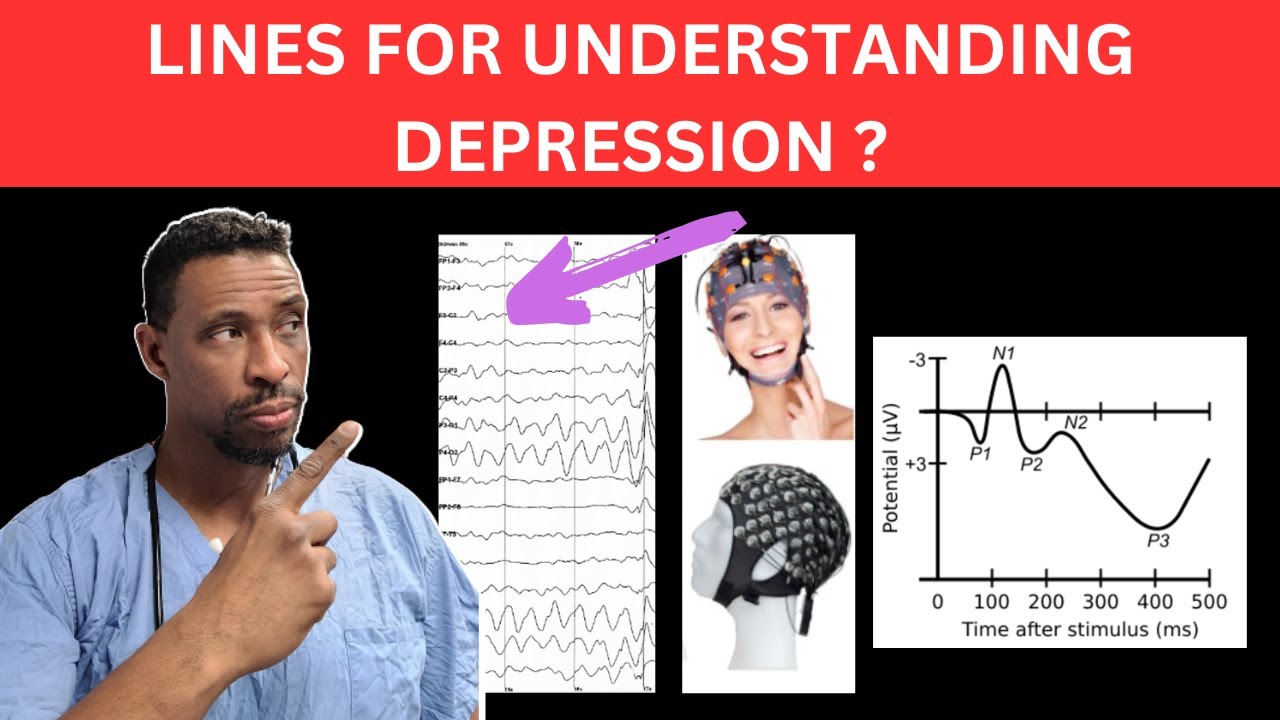 EEG, QEEG and ERP : How these squiggly lines can help improve ...