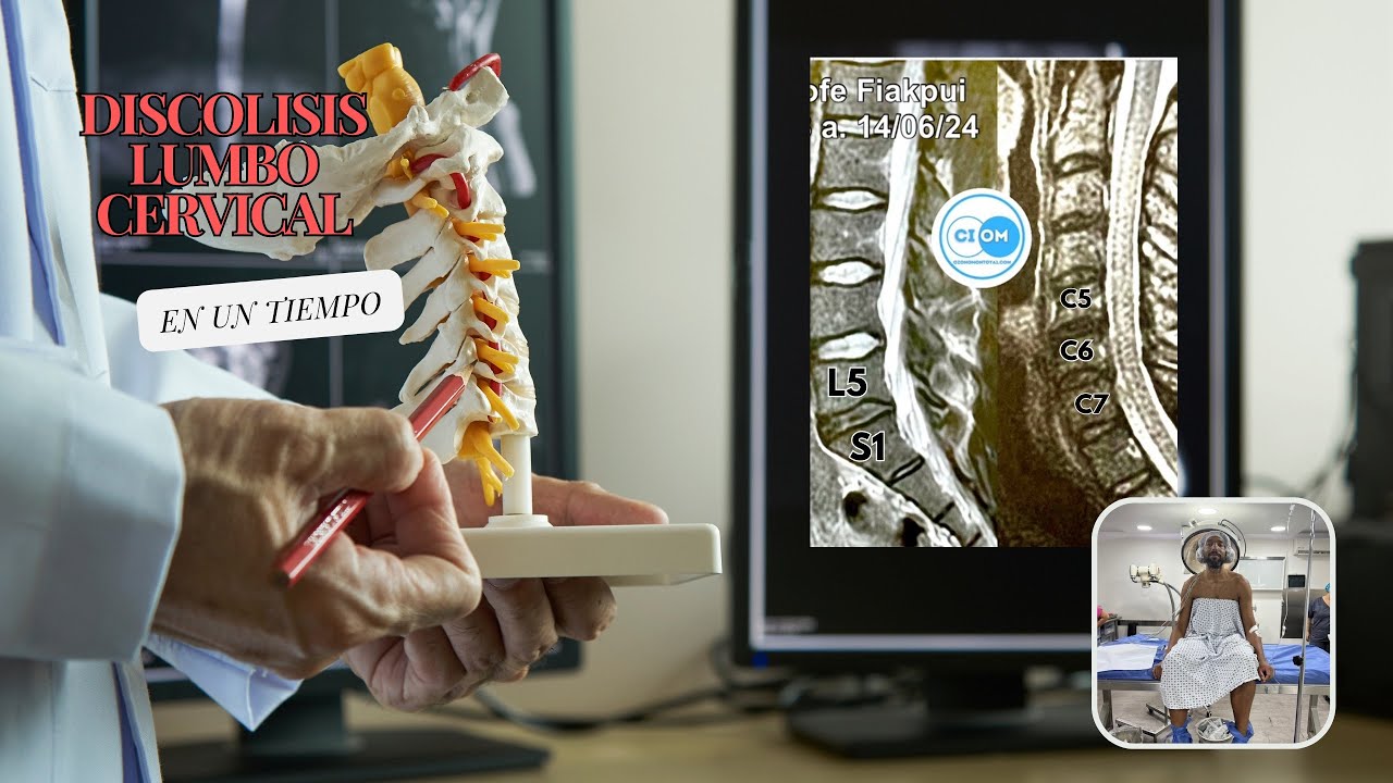 Hernias Lumbo-Cervicales tratamiento sin Cirugía dos regiones ...