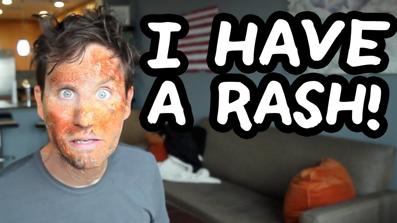 I have a rash! - YouTube