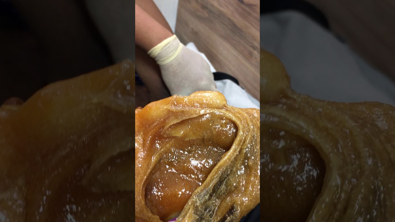 AMAZING SUGARING TECHNIQUE - YouTube