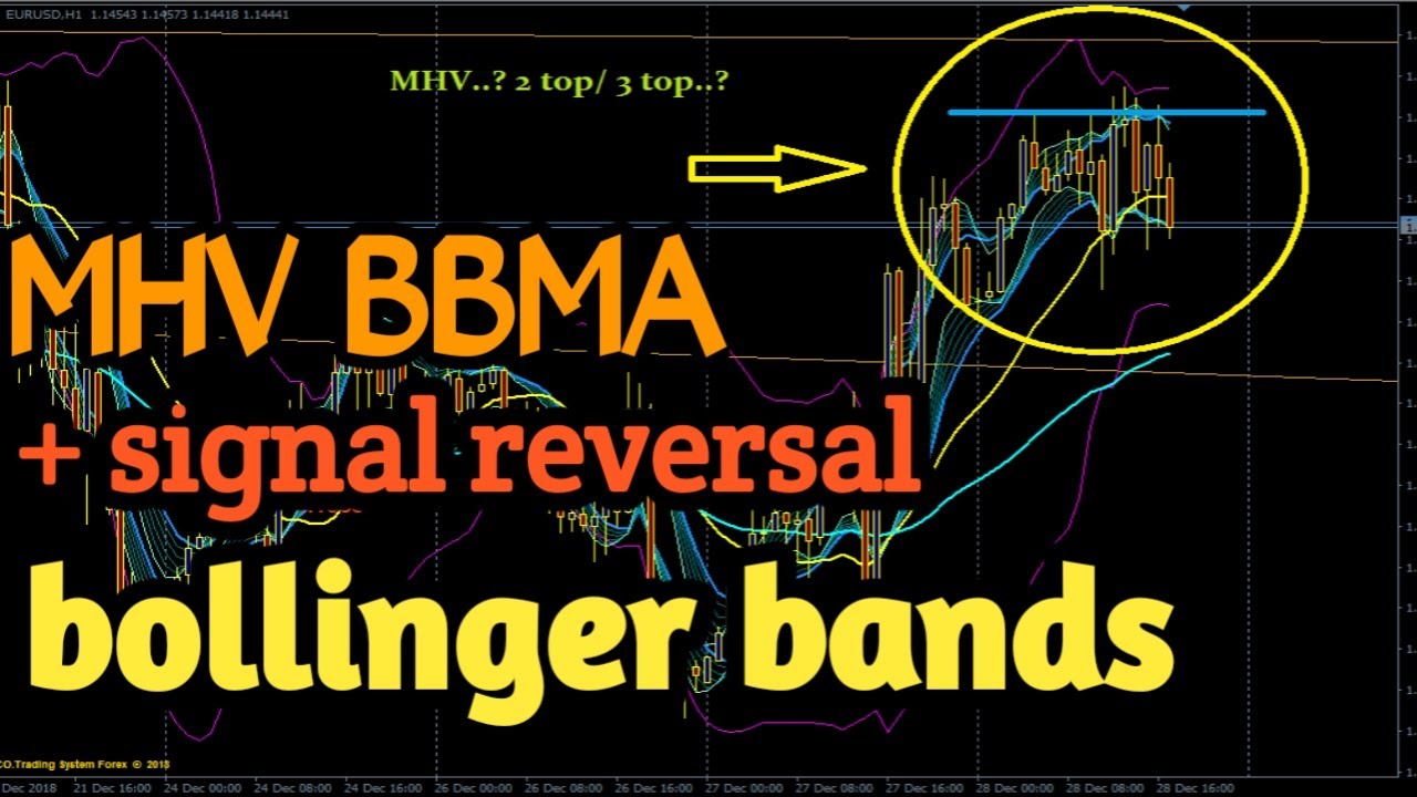 MHV BBMA, SETUP KILLER BBMA OA, BBMA OMA ALLY ADVANCE, BBMA OMA ALLY ...