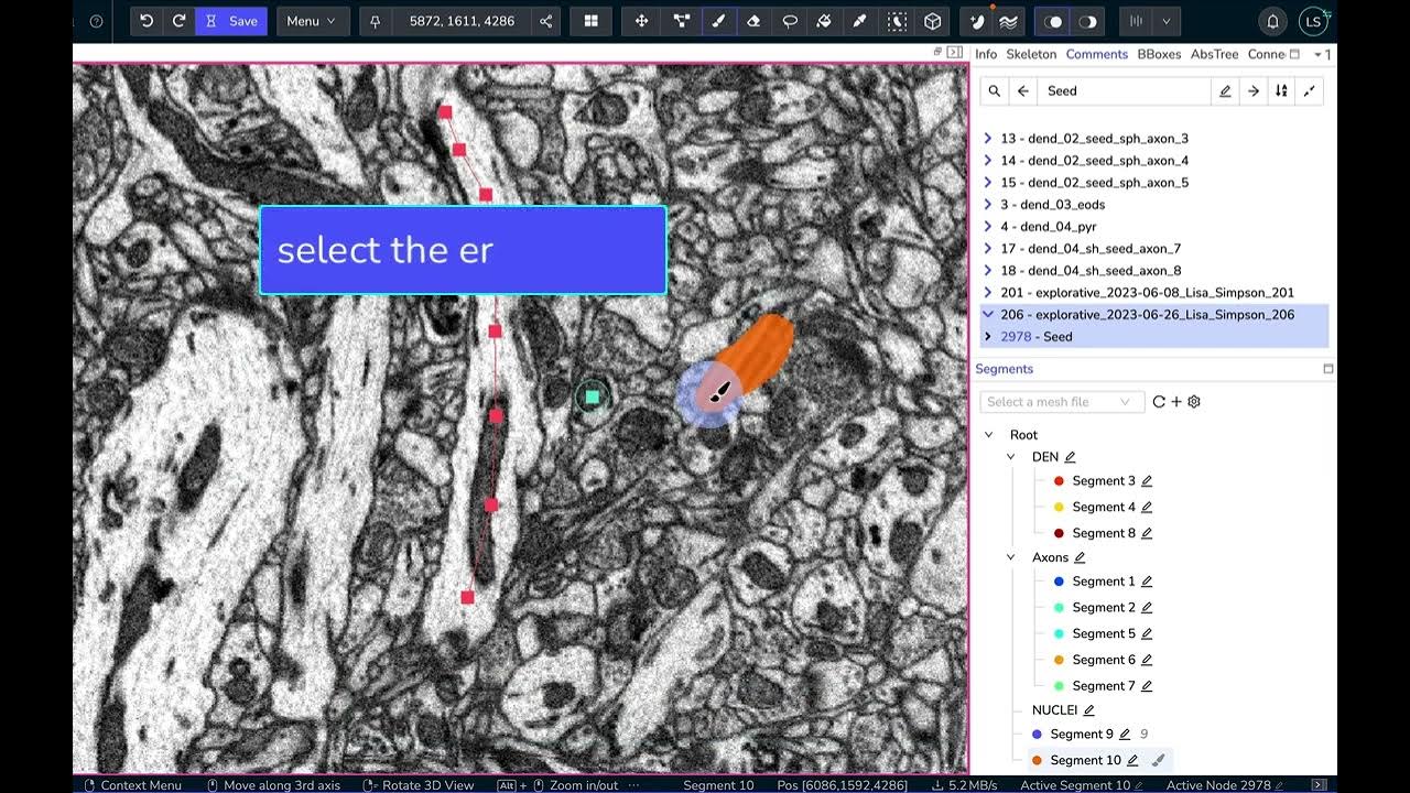 Annotation workflow using keyboard shortcuts in WEBKNOSSOS - YouTube