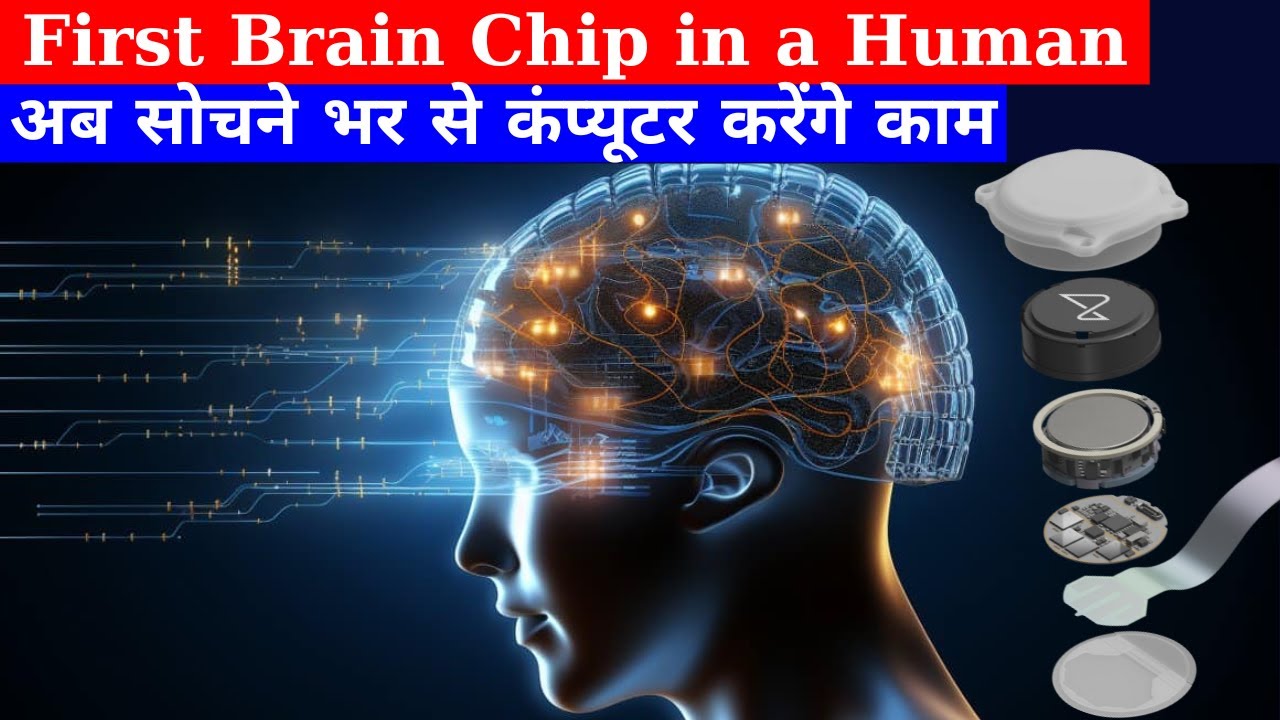 First Brain Chip in a Human II अब सोचने भर से फ़ोन और लैपटॉप करेंगे काम ...